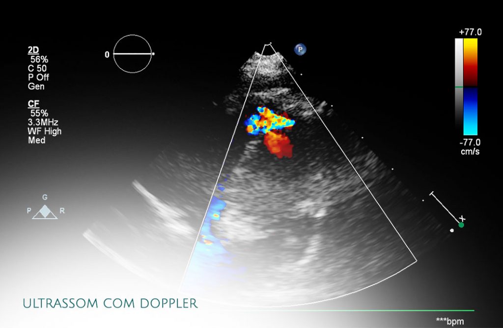 Doppler no ultrassom durante a gestação: qual é a função? - Dra ...